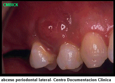 10.- Que es la enfermedad periodontal